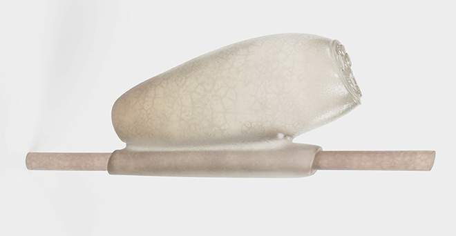 Kopfläuse erkennen | Kopfläuse