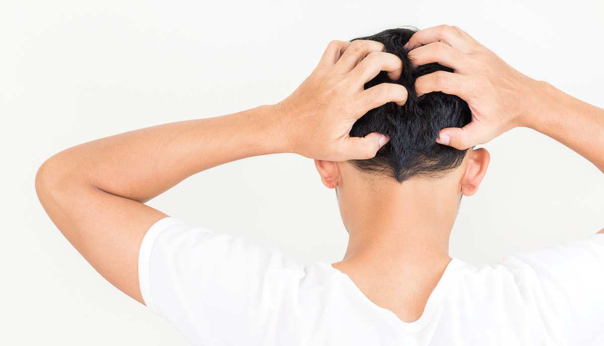 Kopfläuse erkennen | Kopfläuse